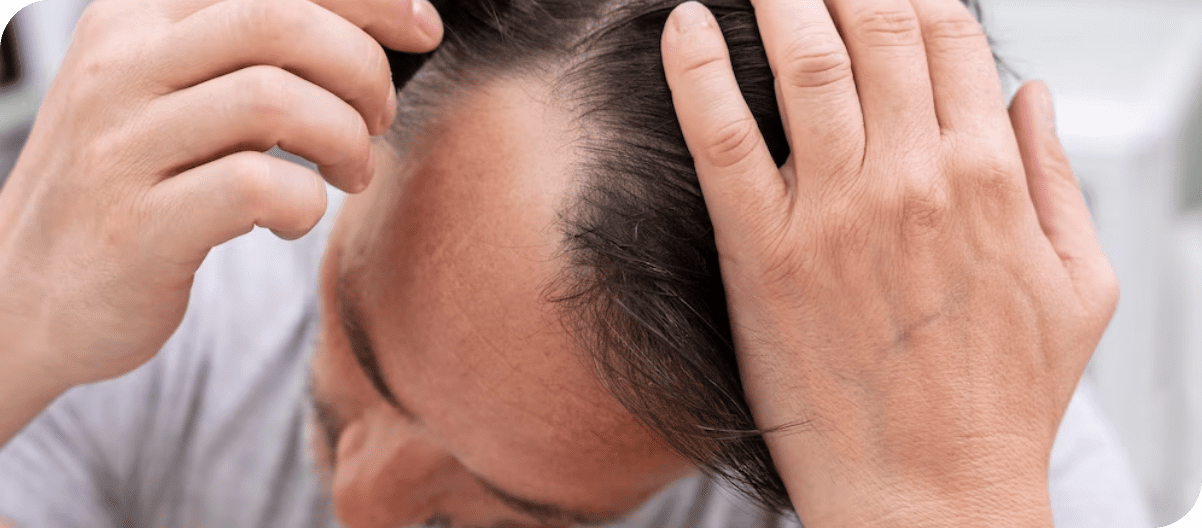 Men's Hair Control and Treatment Solutions for Healthy & Stylish Hair